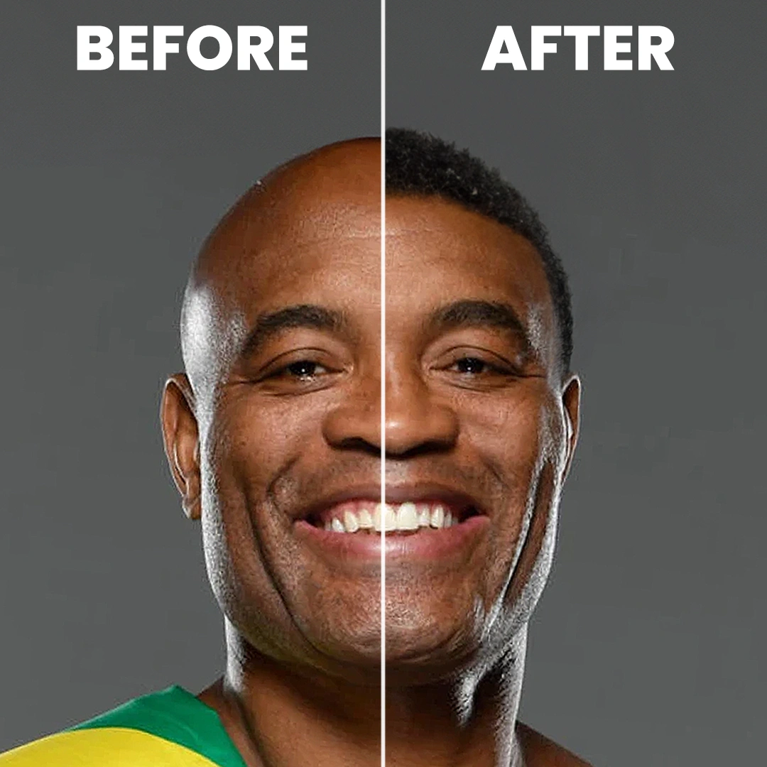 Anderson Silva: MMA Icon's Evolution of Style