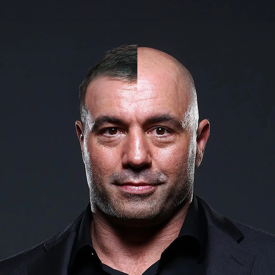Joe Rogan with hair! Witness his hair transplant simulation