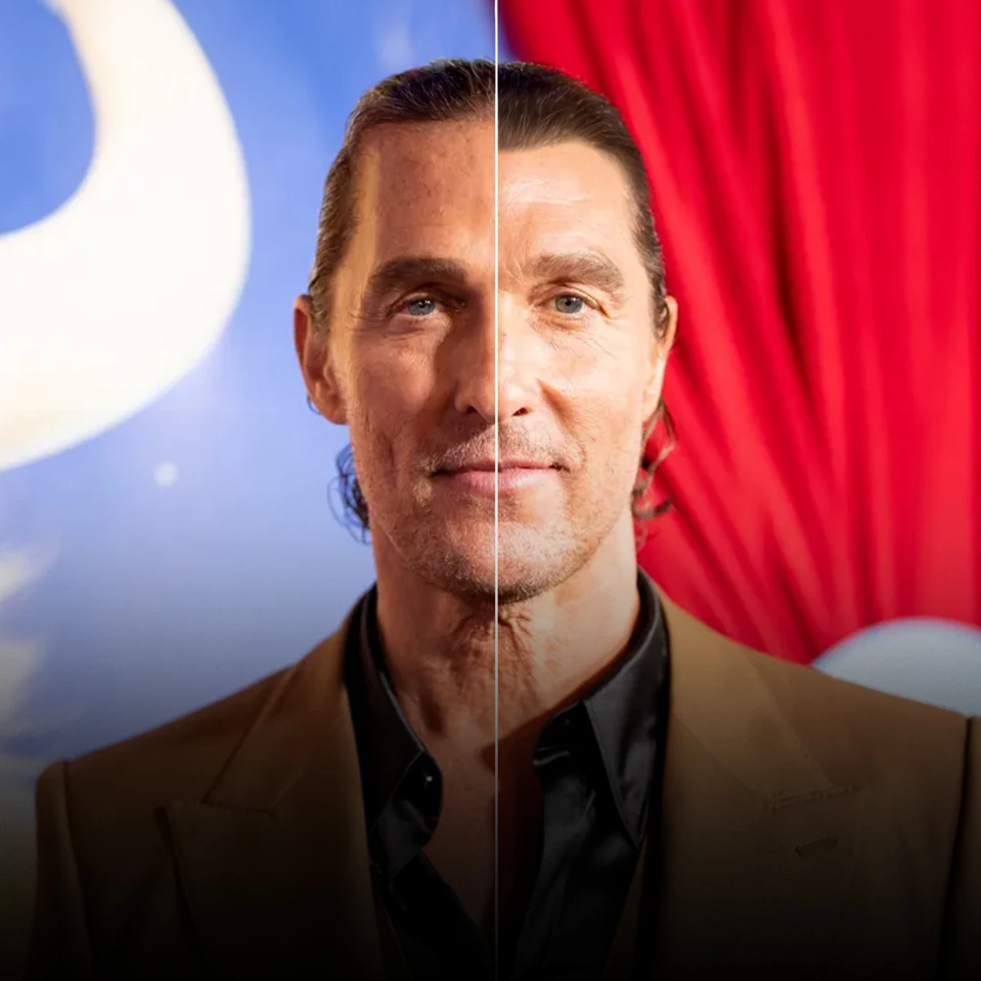 Witness the Matthew McConaughey hair transplant simulation!