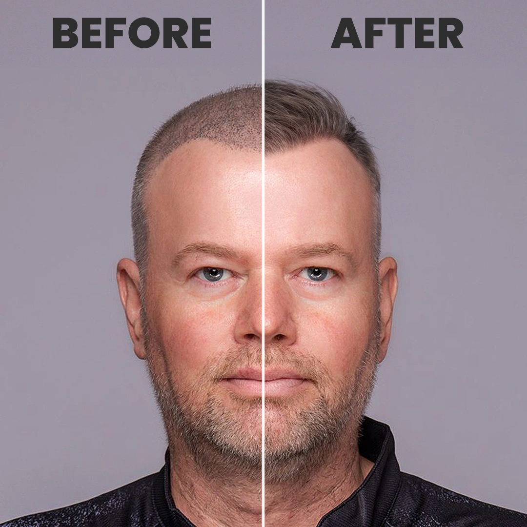 Champion Raymond van Barneveld Transformation | Simulation