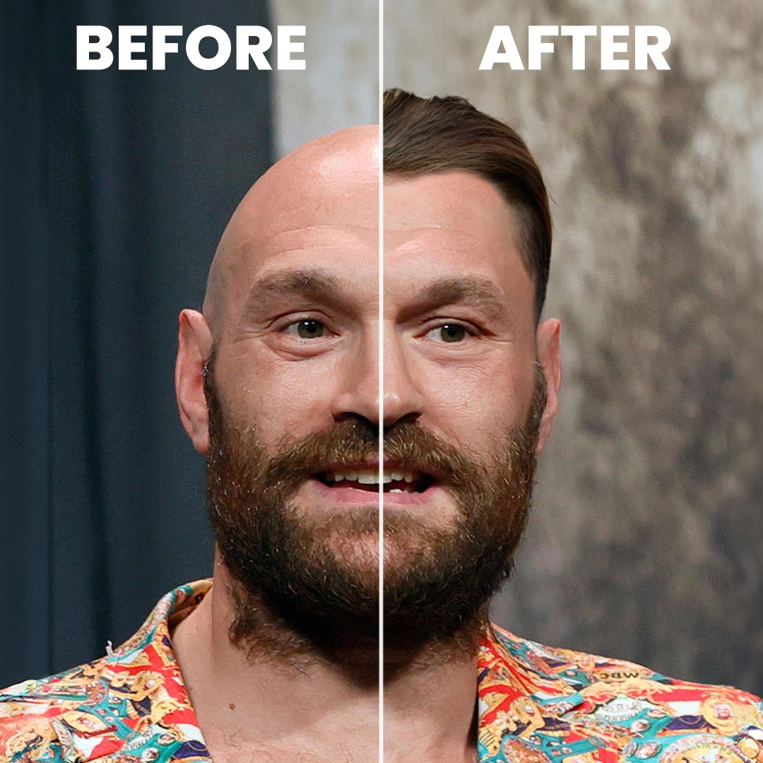 Tyson Fury Amazing Hair Simulation Result